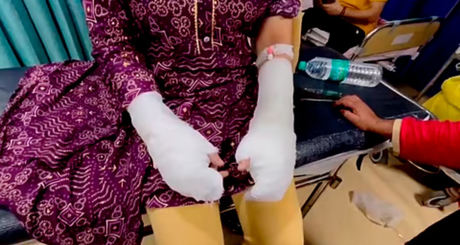DU student suffers acid attack near Laxmibai College