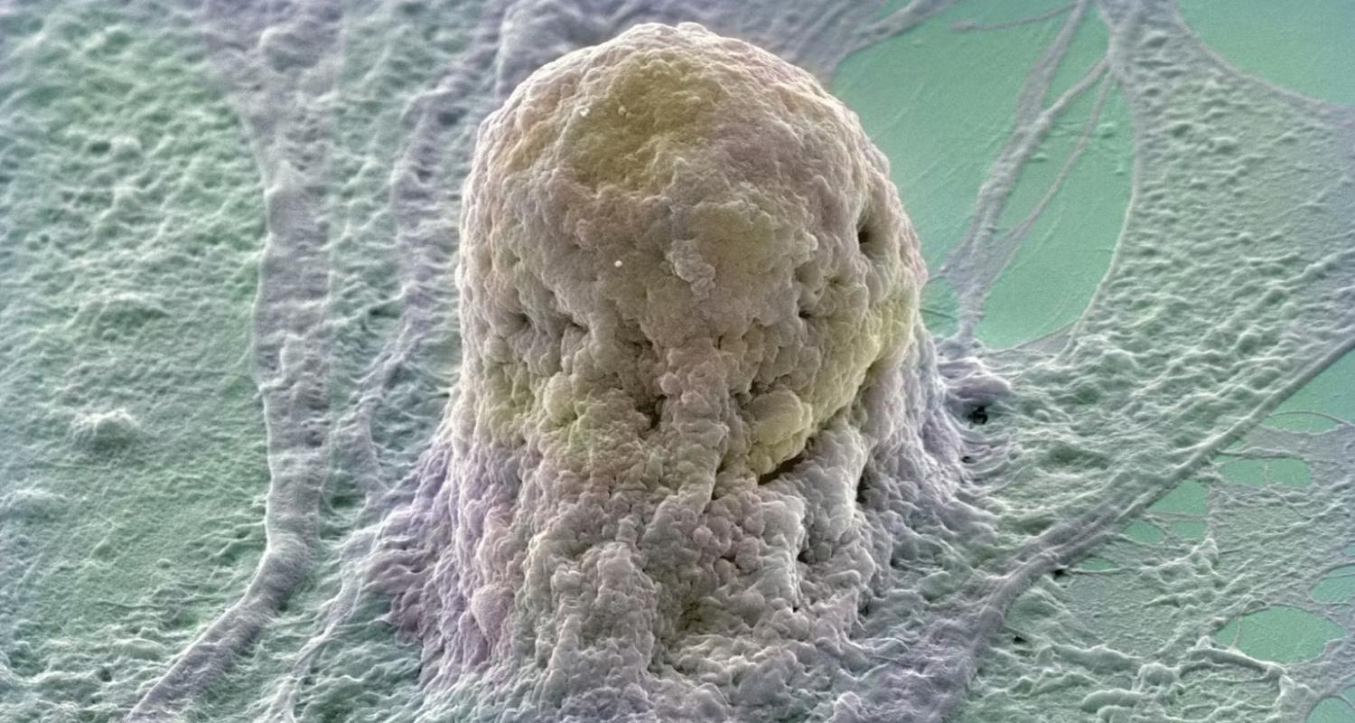 Stem cells: The future of diabetes care